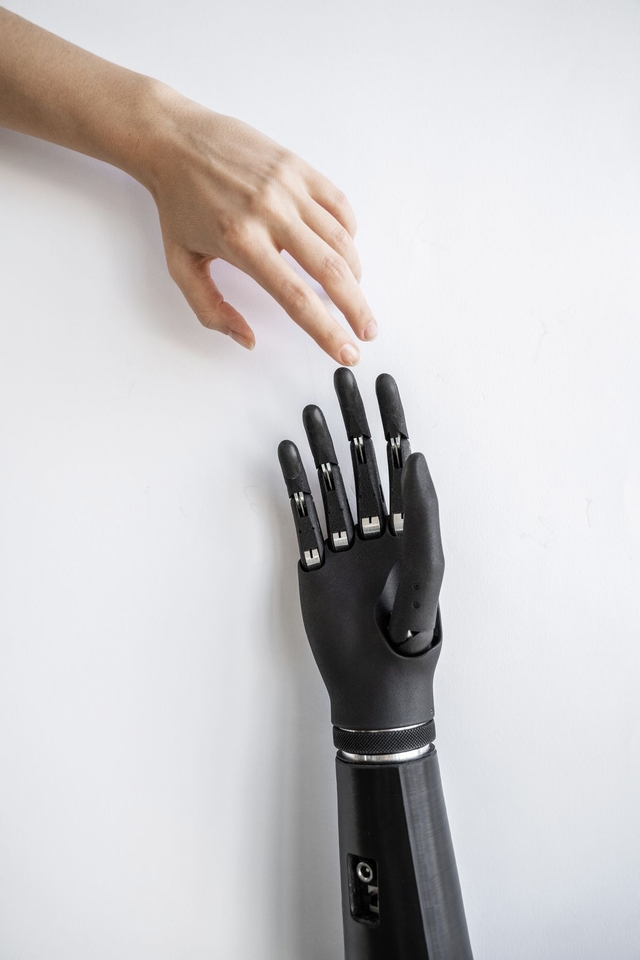 Pushing boundaries of prosthetics, Ukrainian startup Esper Bionics makes cyborgs a reality