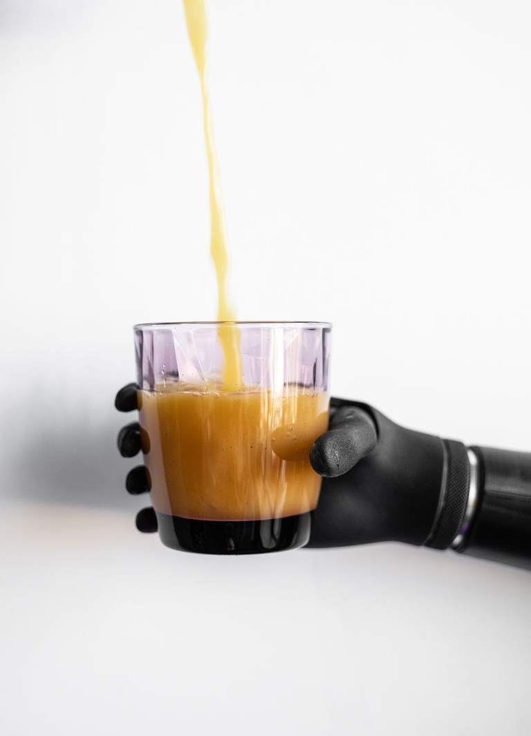 Pushing boundaries of prosthetics, Ukrainian startup Esper Bionics ...