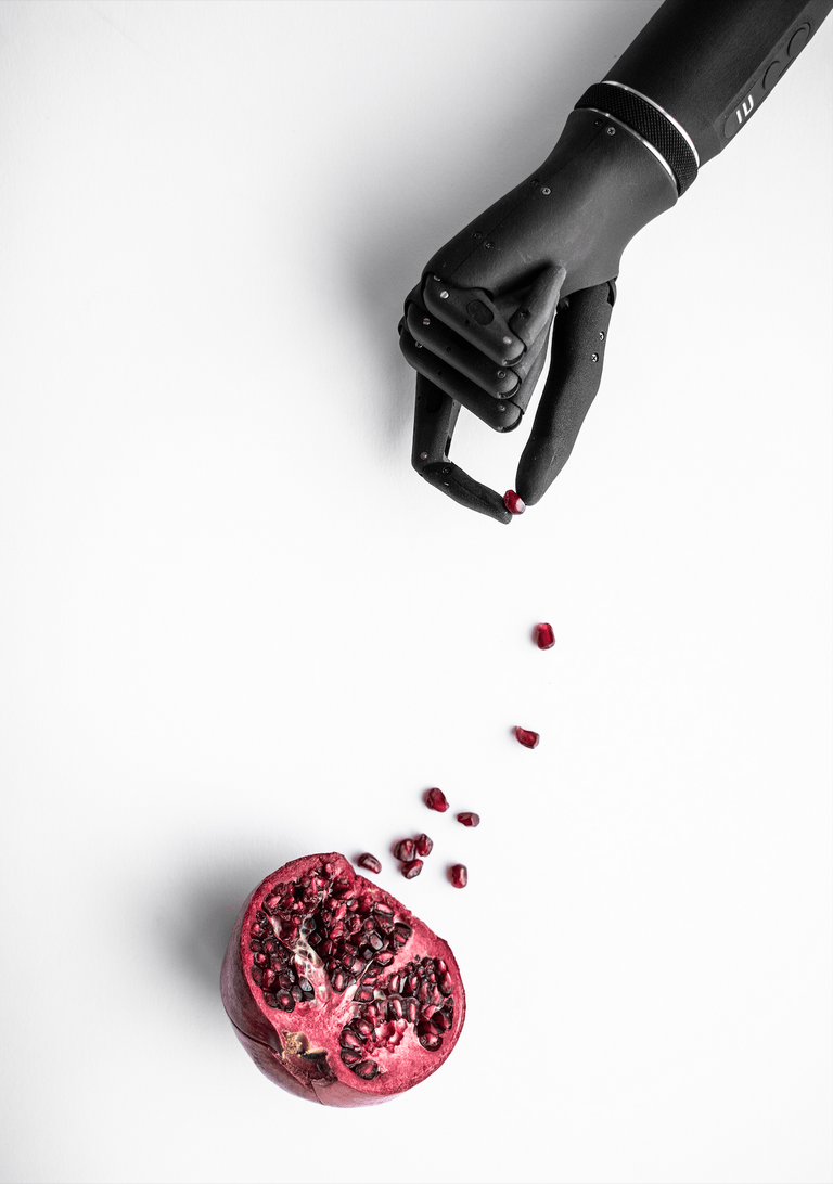 Pushing boundaries of prosthetics, Ukrainian startup Esper Bionics ...