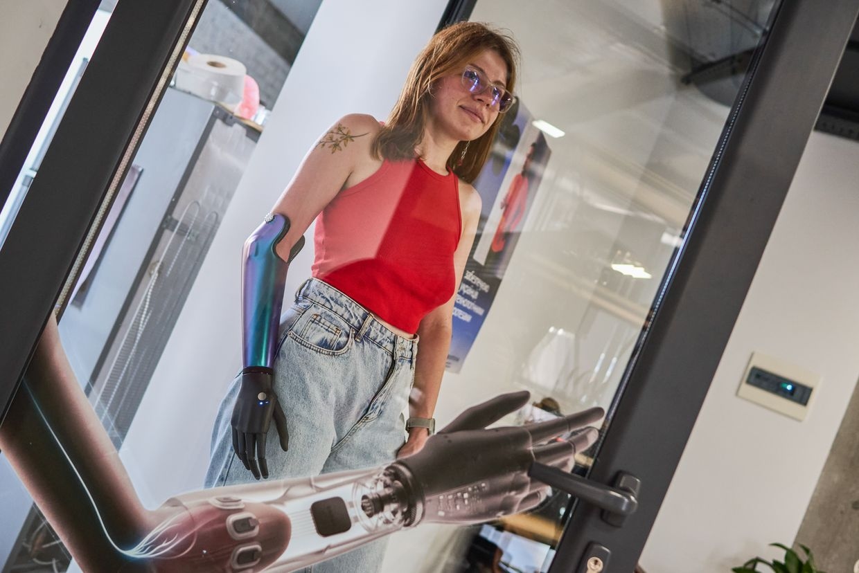 Pushing boundaries of prosthetics, Ukrainian startup Esper Bionics ...