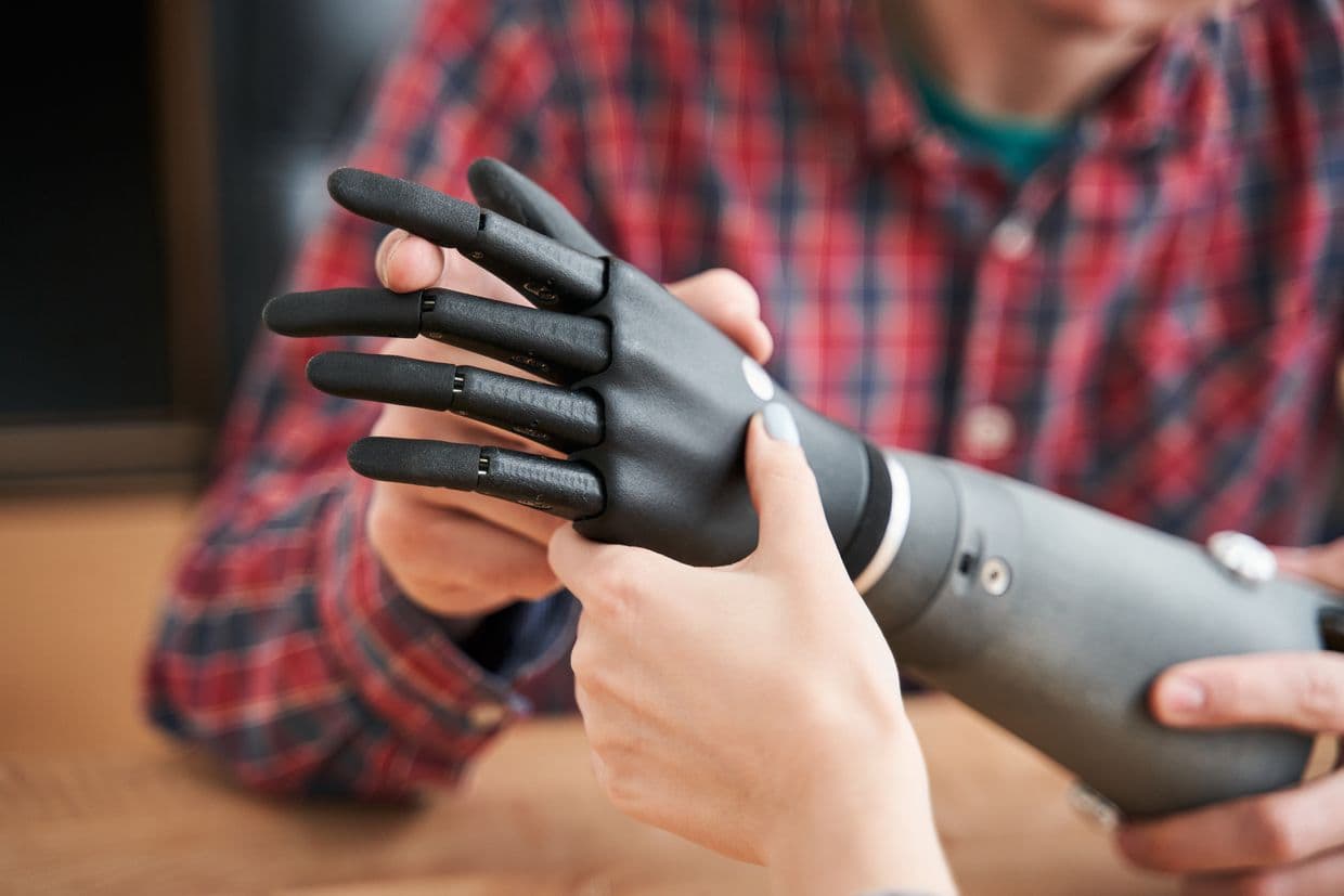 Pushing boundaries of prosthetics, Ukrainian startup Esper Bionics ...